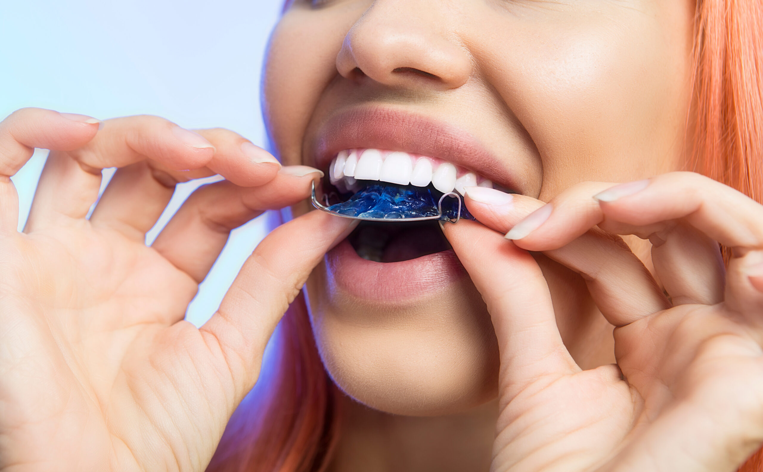 Correcting Smiles With A Retainer - Riverside Dental Group