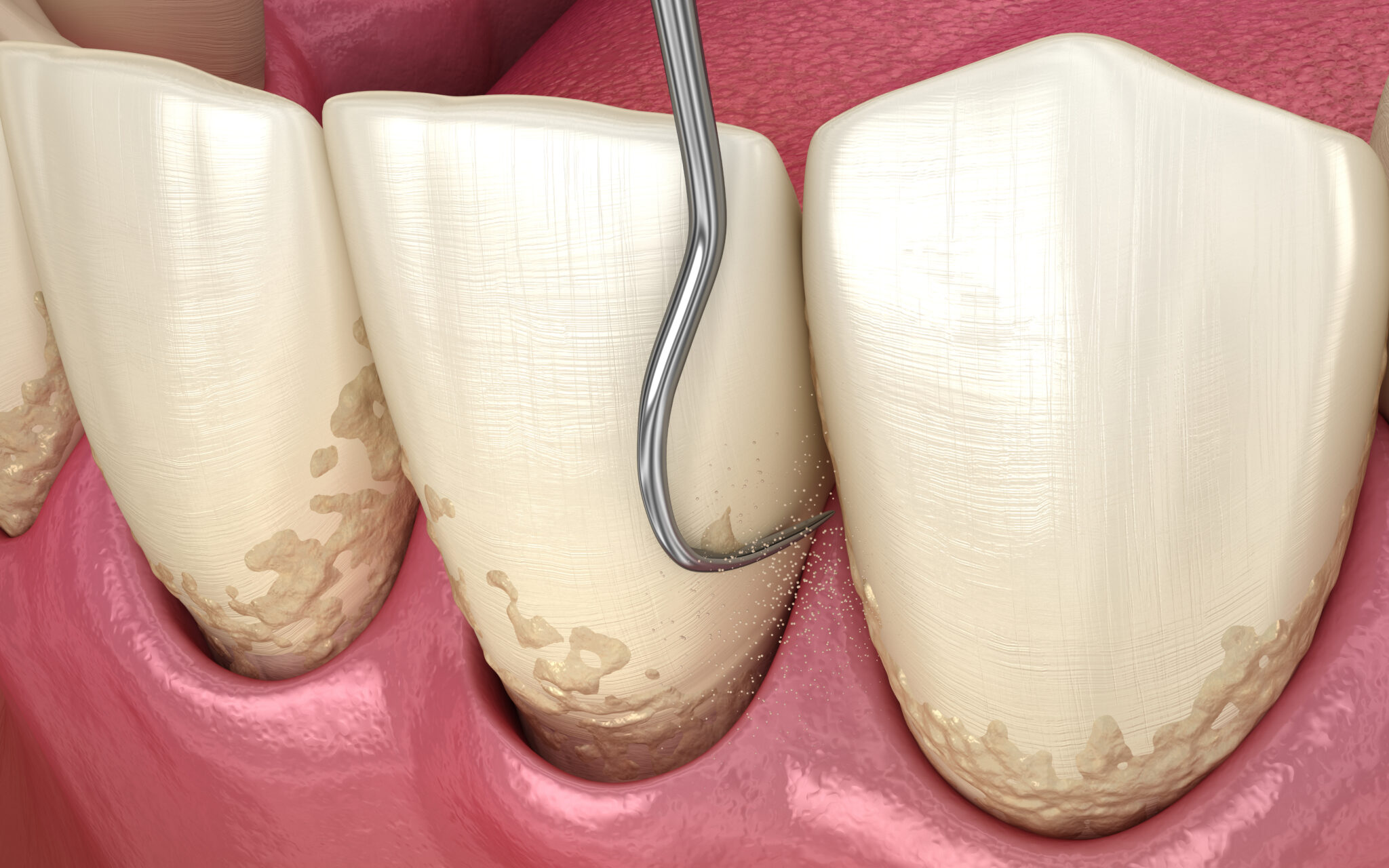 How Periodontics Keeps Smiles Whole - Riverside Dental Group