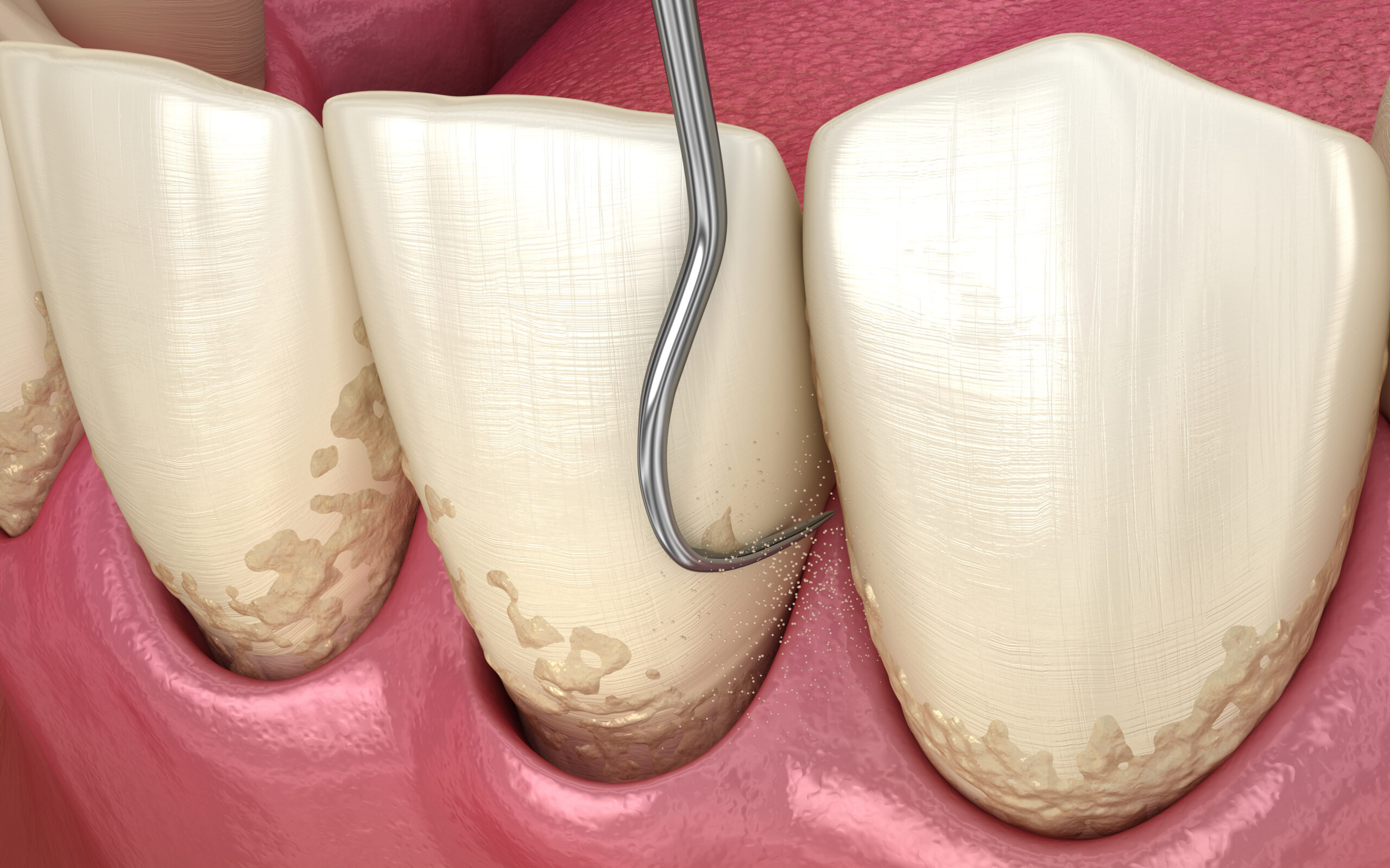 How Periodontics Keeps Smiles Whole - Riverside Dental Group