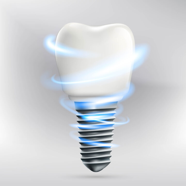 How Implants Act Like Natural Teeth - Riverside Dental Group