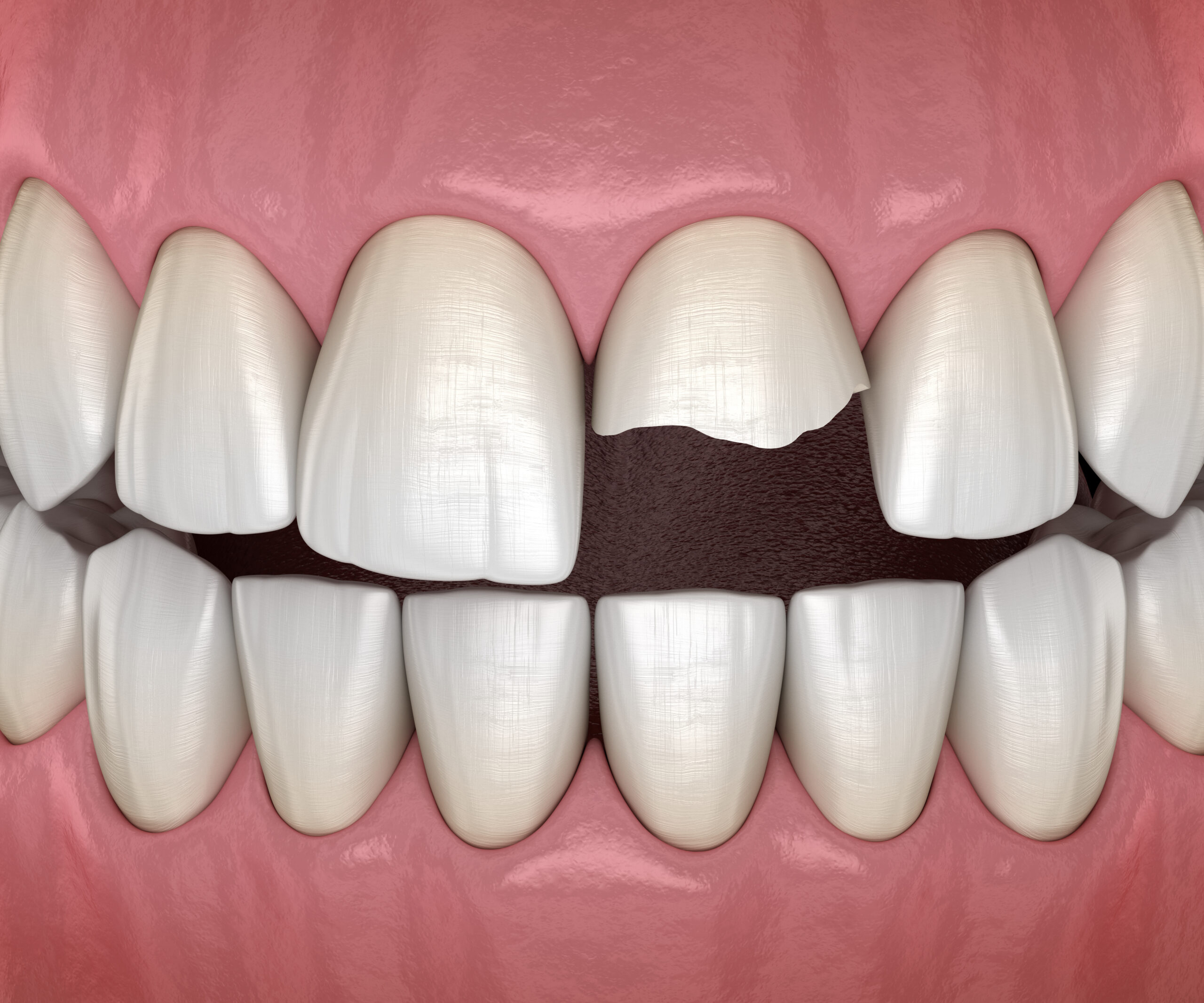 What To Do Following An Emergency - Riverside Dental Group