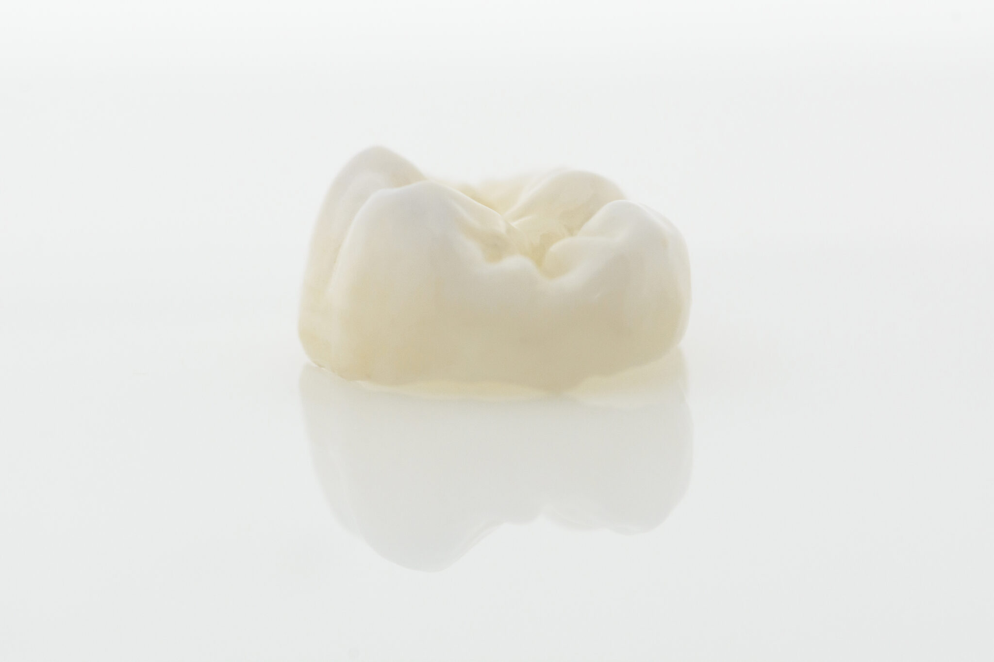 Restoring Smiles With Partial Crowns - Riverside Dental Group