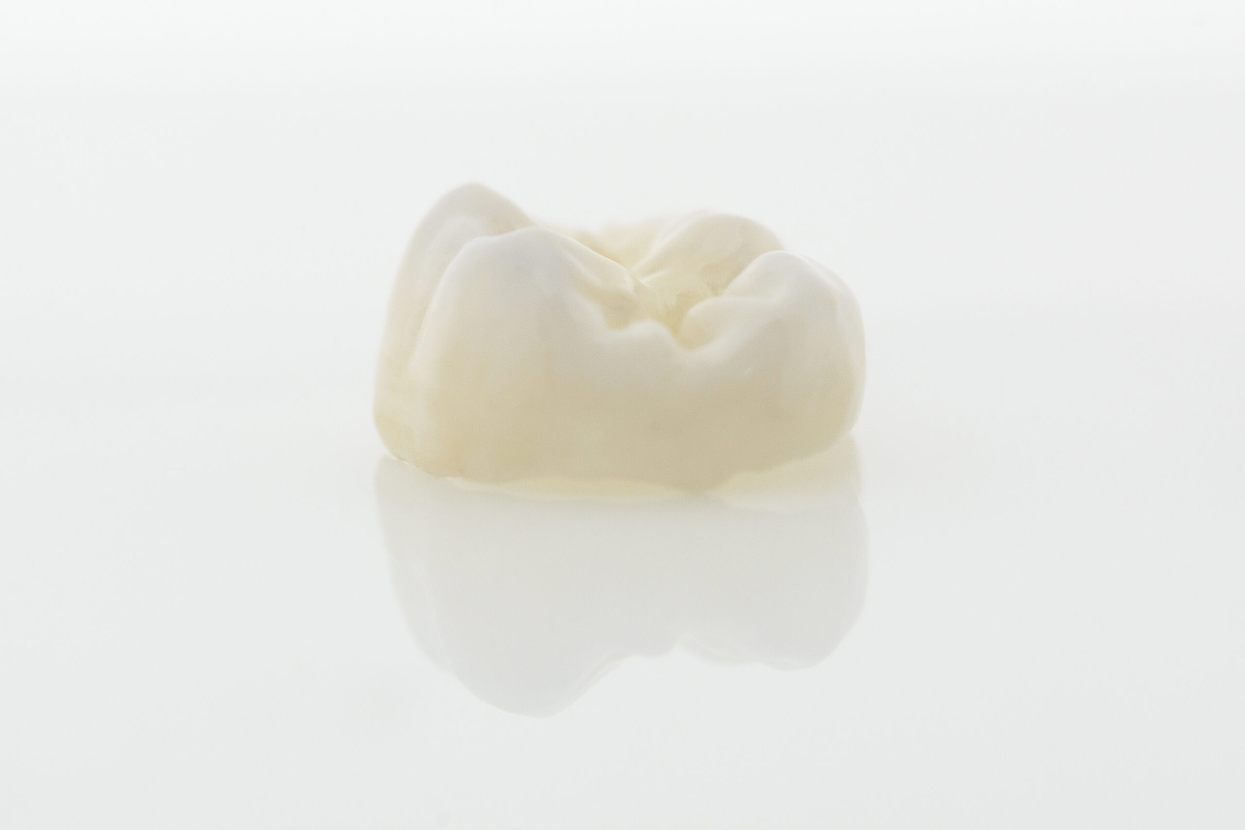 Restoring Smiles With Partial Crowns - Riverside Dental Group